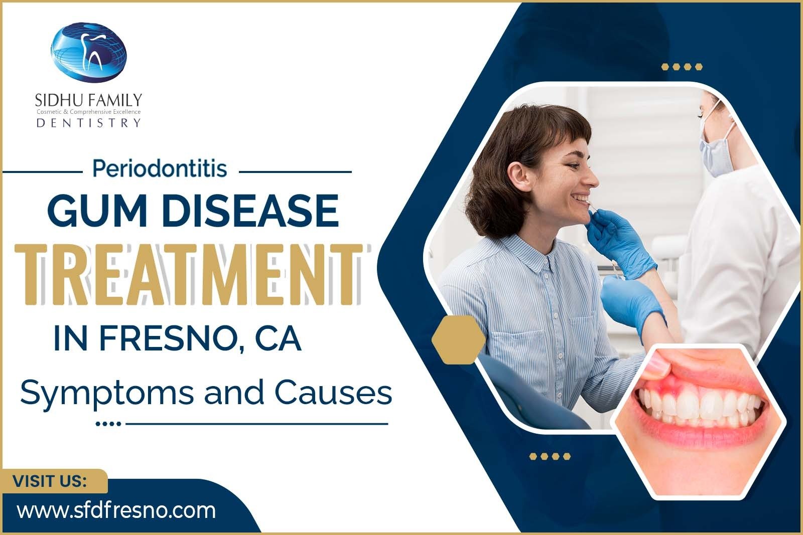Periodontitis Gum Disease Treatment In Fresno Ca Symptoms And Causes